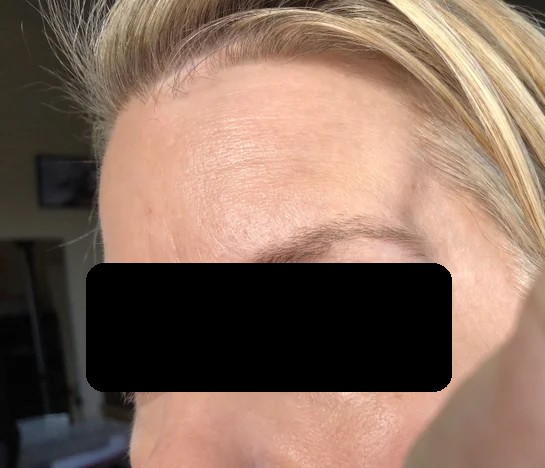 Temple Hollowing – BeautyDigger